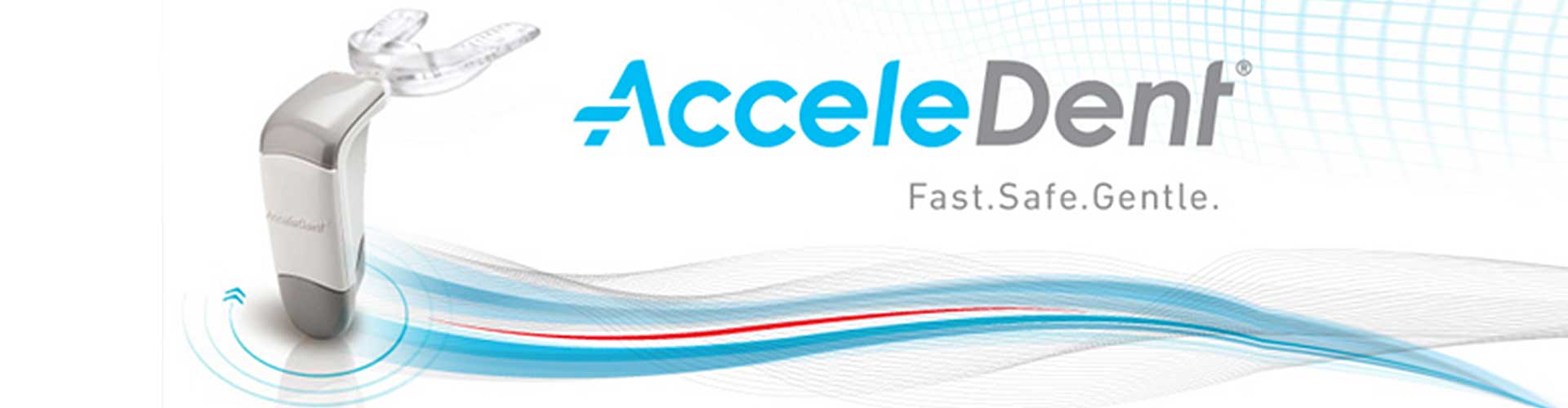 How Does Acceledent ™ Work? | American Canyon Orthodontics